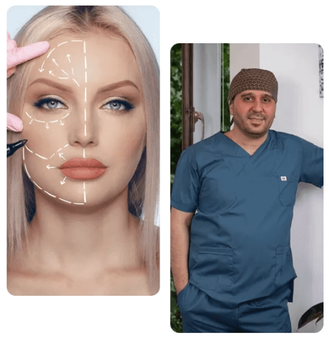 Facelift in Turkey, Istanbul • Best Costs & Surgeon Review