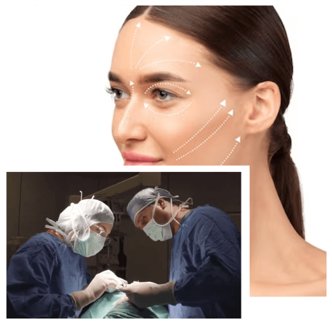 Endoscopic Facelift in Turkey, Istanbul | Dr. Hasan Duygulu