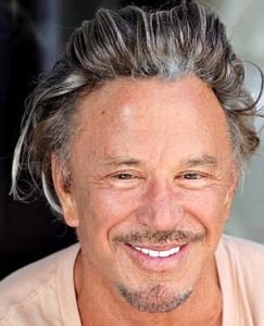 Best Celebrity Facelifts Before and After